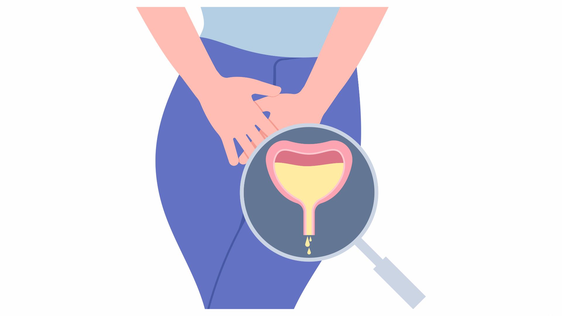 Cirugía de incontinencia urinaria | Hospital de Bellvitge